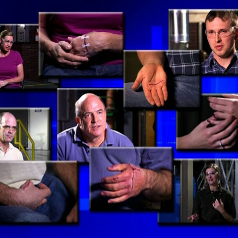 Lessons Learned From Hand Injuries — AP Safety Training